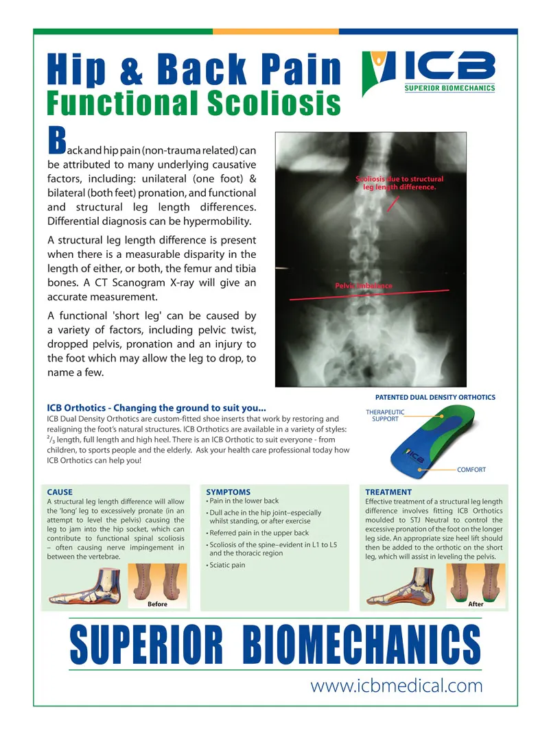 FREE Hip & Back Pain A2 Poster