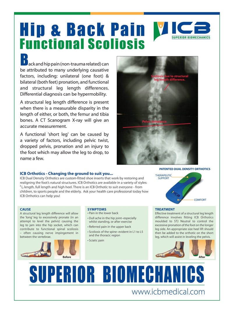 FREE Hip & Back Pain A2 Poster